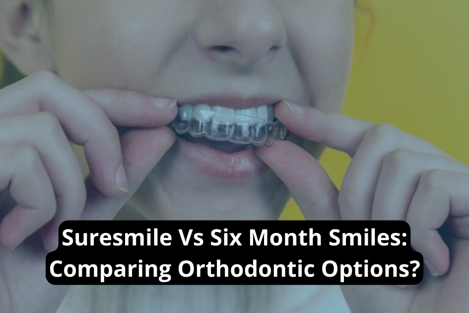 Suresmile Vs Six Month Smiles: Comparing Orthodontic Options ...